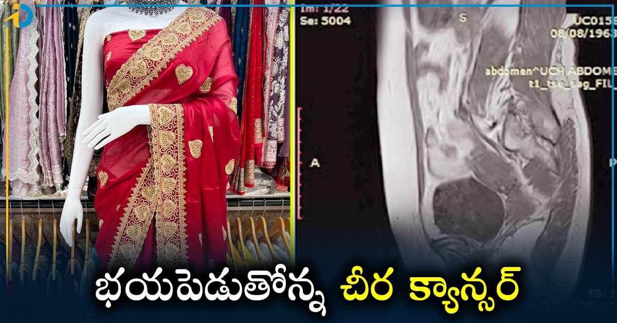 ఆడవాళ్లను భయపెడుతోన్న చీర క్యాన్సర్.. ఇందులో నిజమేంత..? - iDreamPost